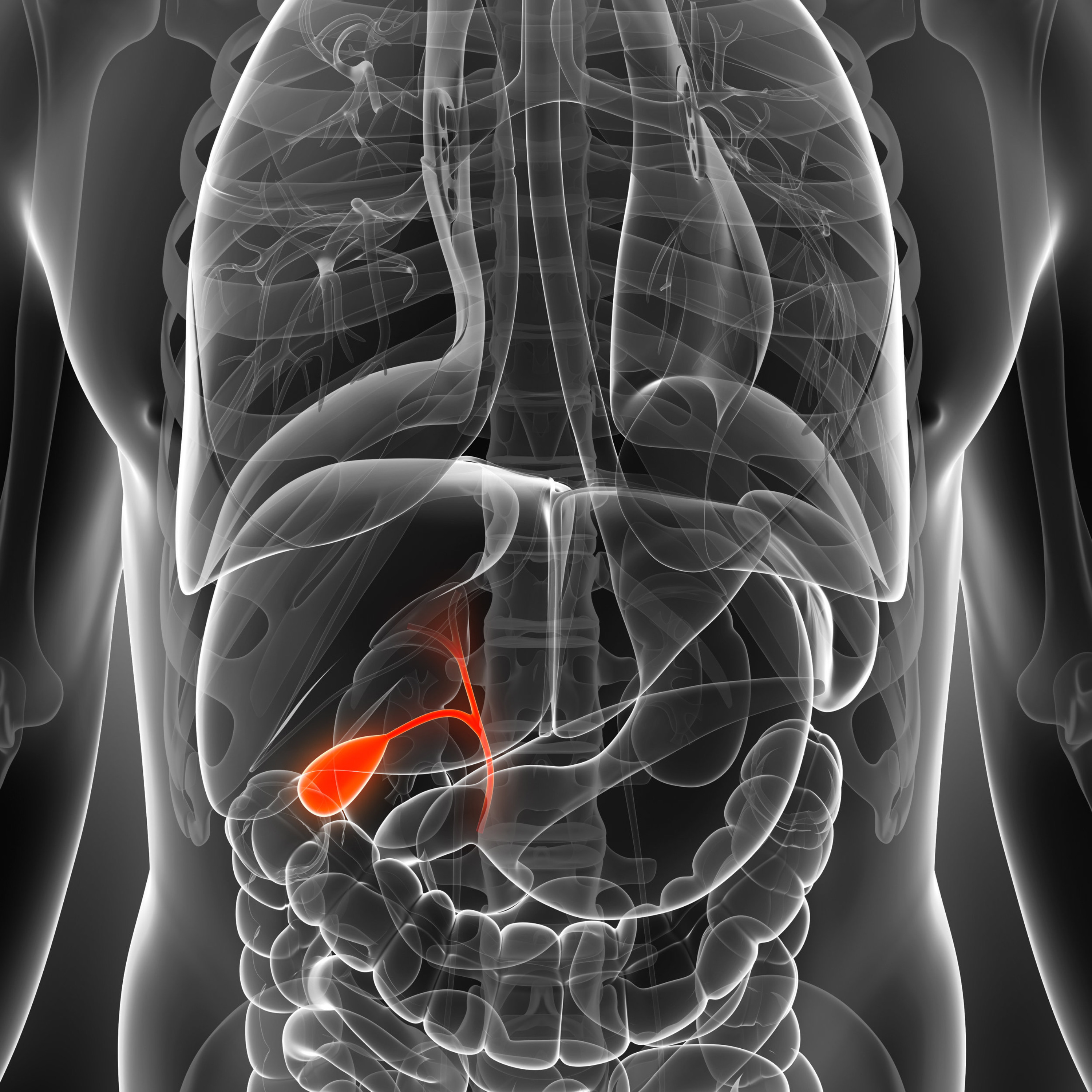 312: Code Word Felix with Daniel Muro Lamere – Overtired